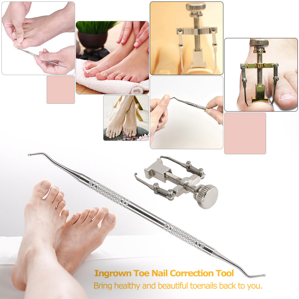 Professional Stainless Steel Ingrown Toenail Correction Tool Set ...